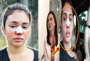 VIRAL: Ivana Alawi Undergoes Nose Restructuring? "Retoke" - AttractTour