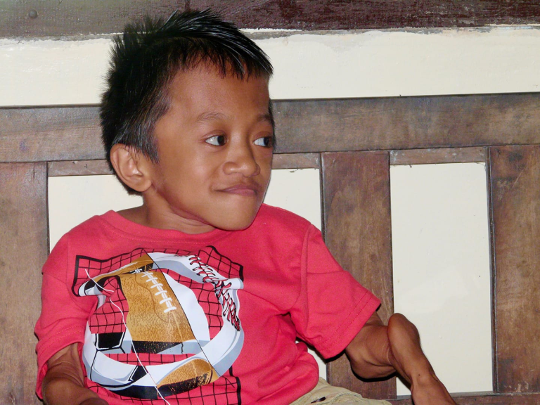 Jann Anthony Gabutan Condition Revealed - AttractTour